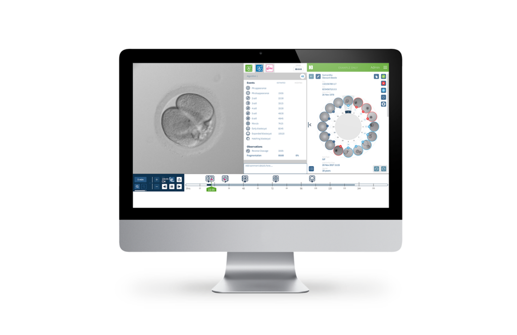 Geri® Connect & Assess - Genea Biomedx